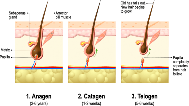Androgenic Alopecia (AGA): What is it, Its Characteristics, Causes, And ...