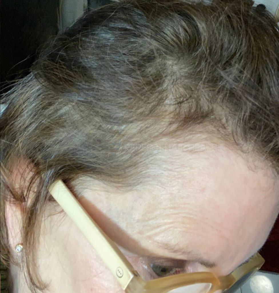 Join Our Membership Community - Perfect Hair Health