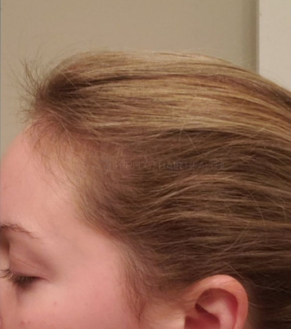 Perfect Hair Health: Exploring the Science Behind Hair Loss & Hair Growth