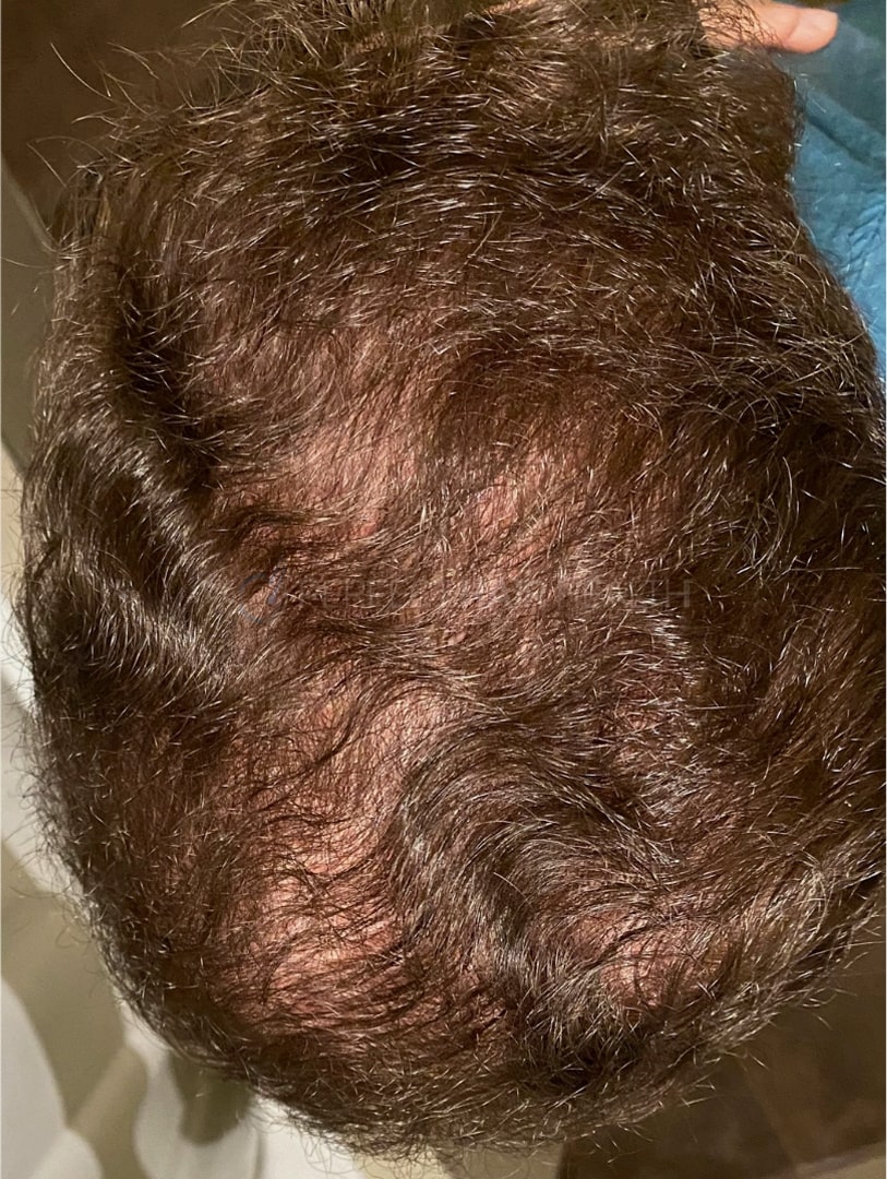 Perfect Hair Health: Exploring the Science Behind Hair Loss & Hair Growth