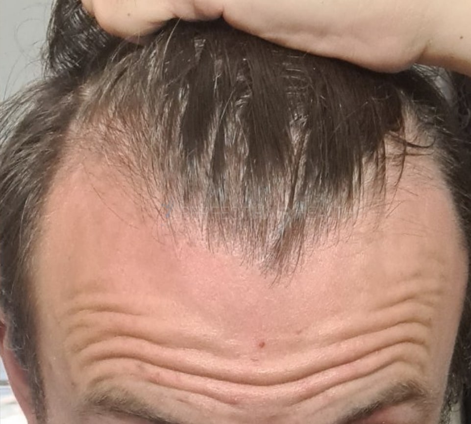 Perfect Hair Health: Exploring the Science Behind Hair Loss & Hair Growth