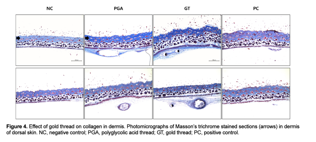 PDO Hair Treatment: Examining Threads of Evidence - Perfect Hair Health
