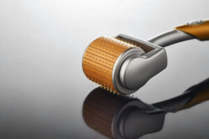Microneedling For Hair Growth: Am I Supposed To Bleed?