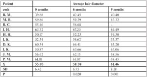 Fluridil: A Topical That Regrows Hair, Without Side Effects ...